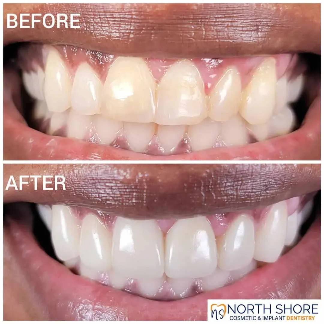 Toothbrush Toys Launches English Tree® and Zoonicorn® Two Minute ...